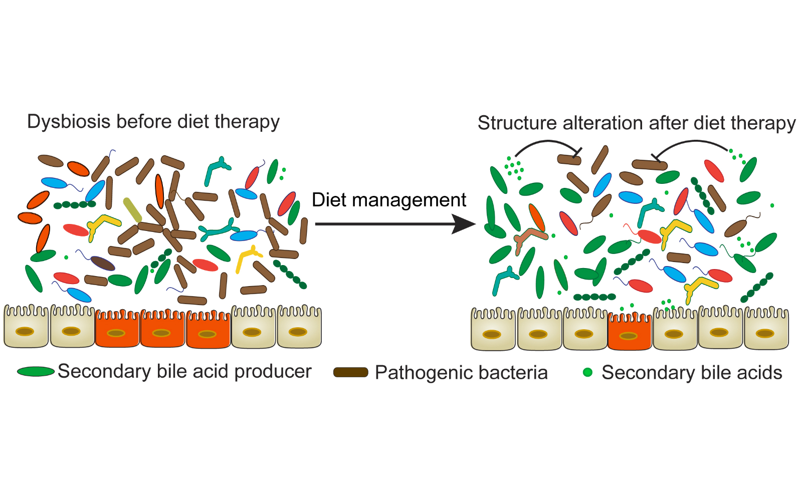 Dysbiosis in IBD Patients | gutmicrobiotaforhealth