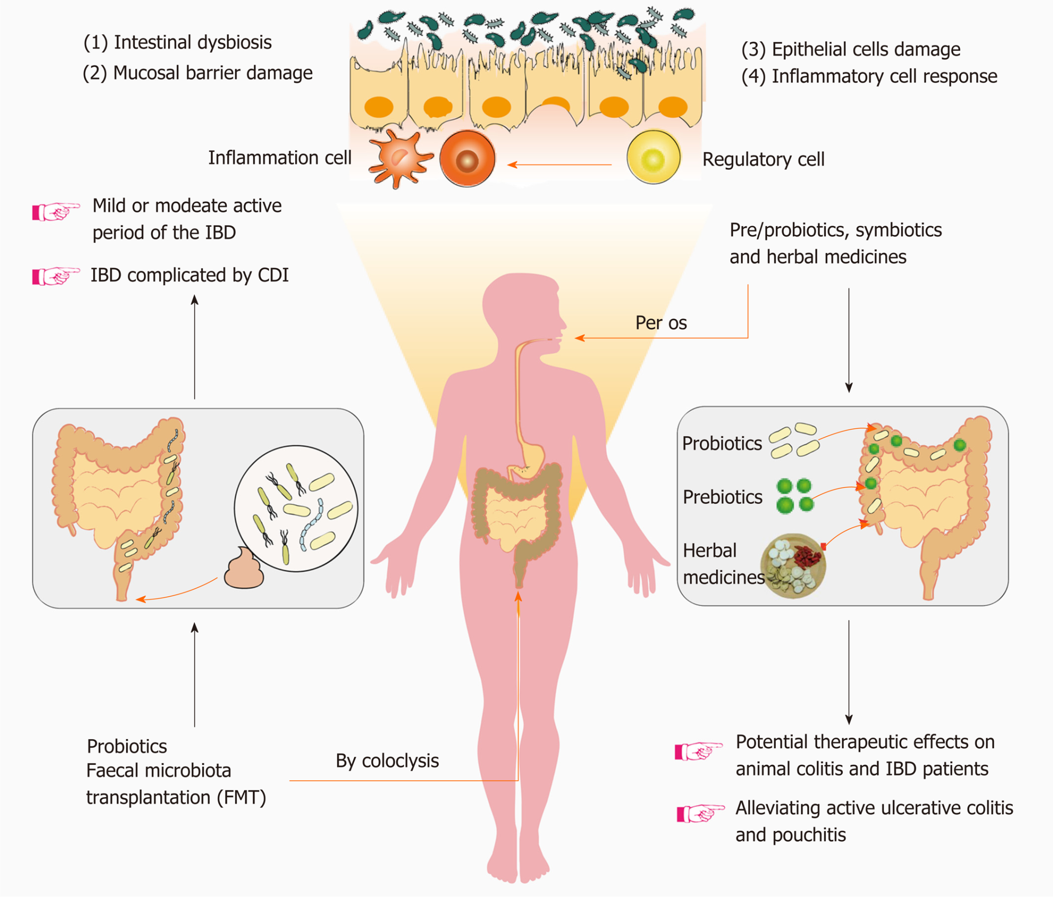 Dysbiosis in IBD Patients | gutmicrobiotaforhealth