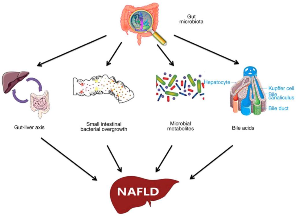 Therapeutic Aspect in Non-Alcoholic Fatty Liver Disease