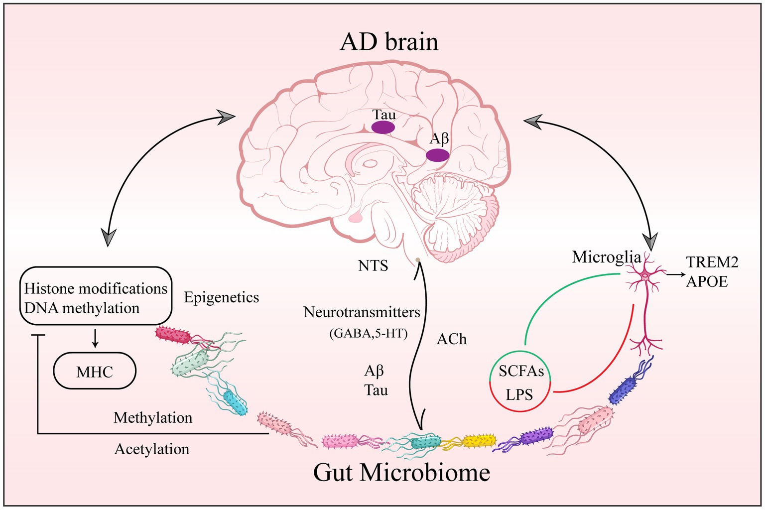 on the effect of gut microbiome on Alzheimer's disease