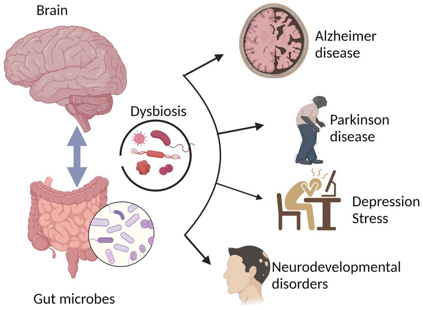 on the effect of gut microbiome on Alzheimer's disease